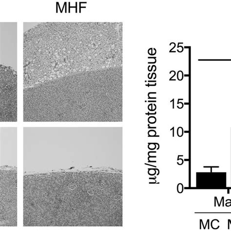 Maternal High Fat Diet Increases Perirenal Fat Deposition And