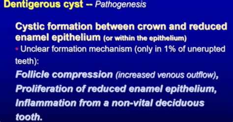 Pathogenesis Of Dentigerous Cyst