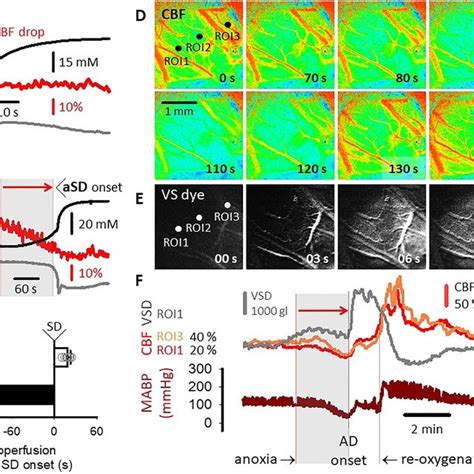 The Temporal Sequence And The Latency Between Spreading Depolarization Download Scientific