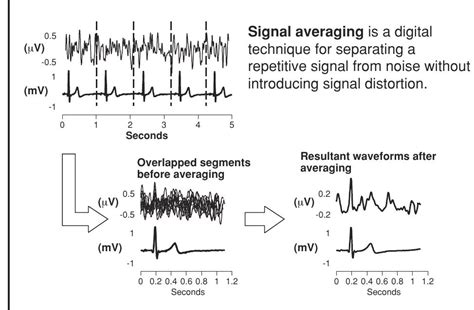 The Sequence Of The Signal Averaging Procedure Is Shown