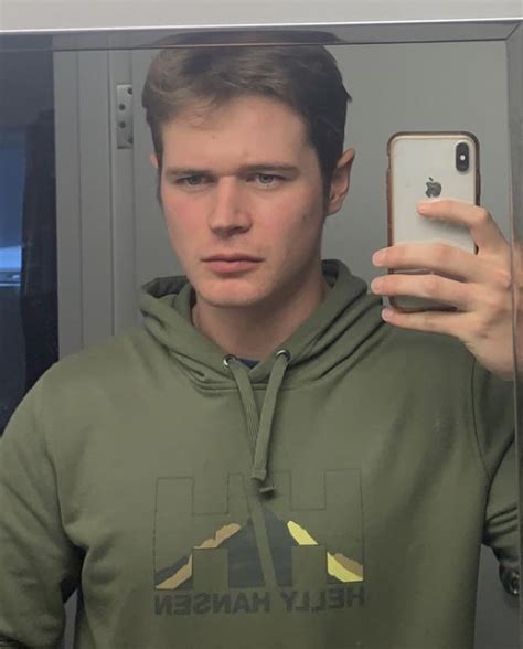 Does Mewing Work In Class Ii Malocclusion Rmewing