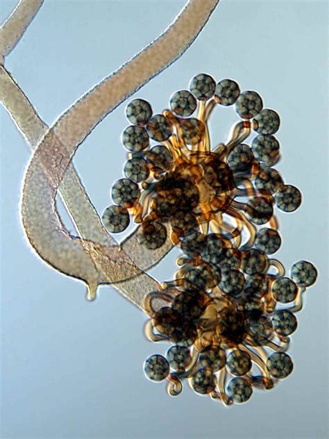 Dreamscape — Drrestless The Hidden Life Of Microscopic Fungi