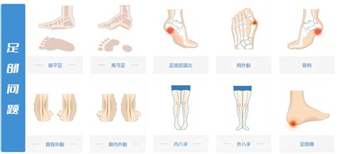 错误步态的影响 高登足脊健康矫形中心