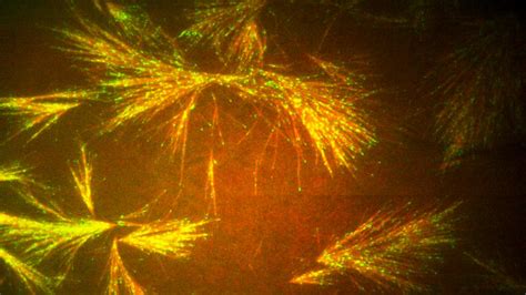 Cellular Scaffolding Rewired To Make Microscopic Railways Department