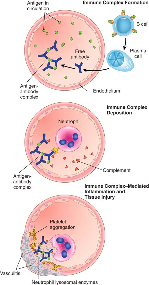 Diseases Of The Immune System Clinical Tree