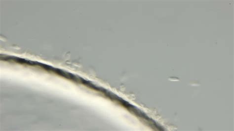 A Tiny Microscopic Protozoan Spins Round And Round By Its Cilia In A Drop