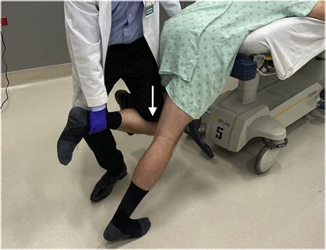 View Posterior Hip Dislocation Reduction Pictures Hot Sex Picture