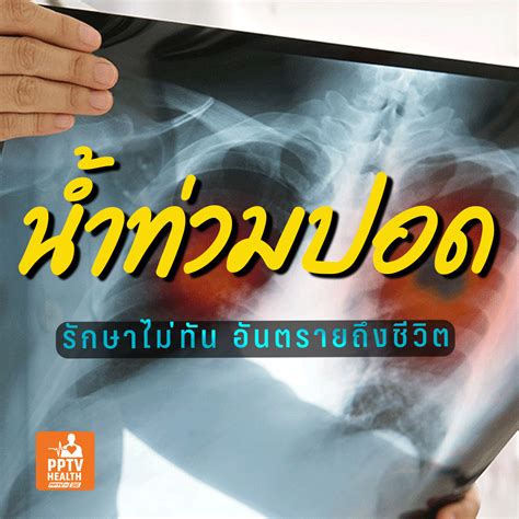 Pptv Hd 36 ภาวะน้ำท่วมปอด คืออะไร