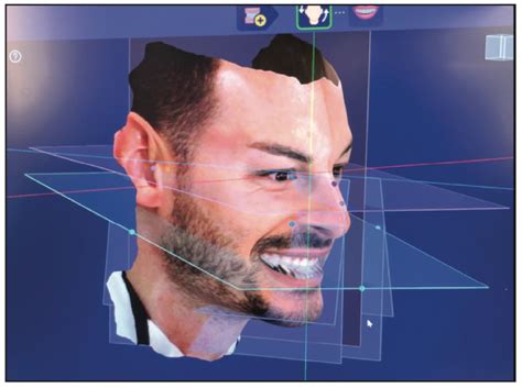 Three Dimensional Facial Scanning A New Paradigm Dentistry Today