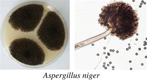 Aspergillus Morphology Clinical Features And Lab Diagnosis • Microbe Online