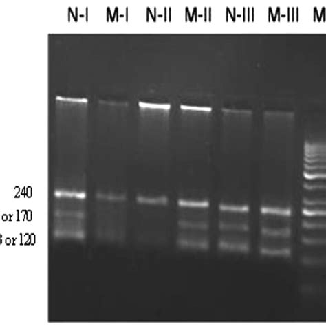 Detection Of Δf508 Cftr Mutation In Infertile Men By Using