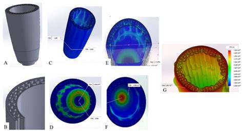 Revolutionizing Prosthetic Design With Auxetic Metamaterials And Structures A Review Of