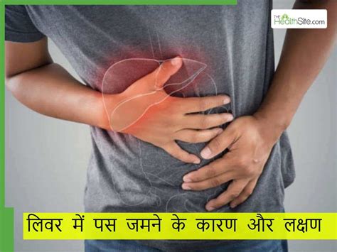 इन कारणों से लिवर में जमने लगता है पस ना करें इन लक्षणों को इग्नोर