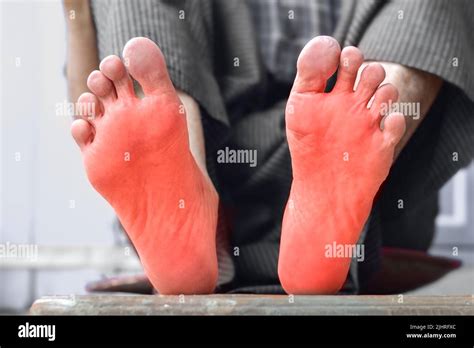 Tingling And Burning Sensation In Feet Of Asian Old Man With Diabetes