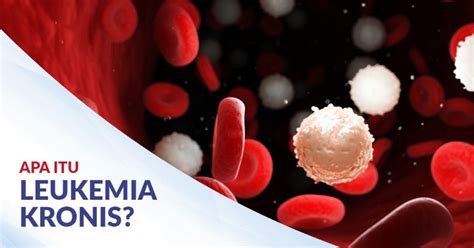Chronic Leukaemia CFCH Centre For Clinical Haematology