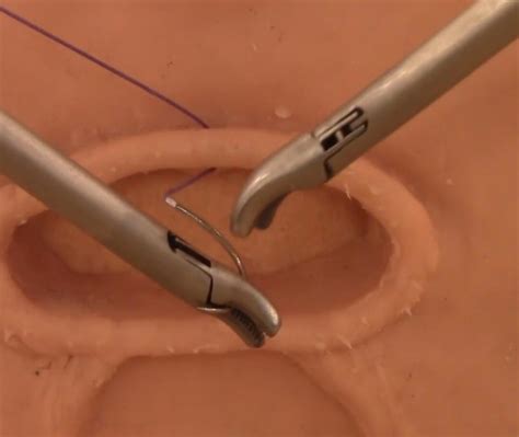Laparoscopic Suturing And Extracorporeal Knot Tying Surgmedia