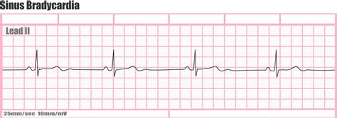 Ecg And Drugs Hoodoo Wallpaper