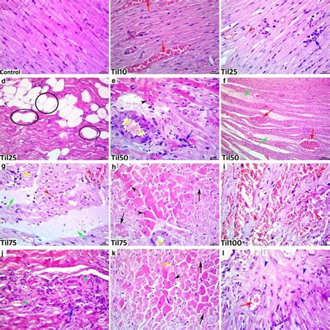 Representative Photomicrograph Of Hande Stained Cardiac Sections Showing