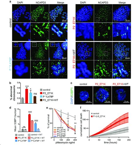 Ttc7a Deficiency Affects Genome Integrity And Survival A Chromosome