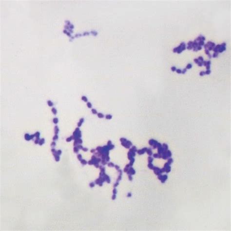Streptococcus Pneumoniae W M Slide CBS Blades Biological Ltd Kent
