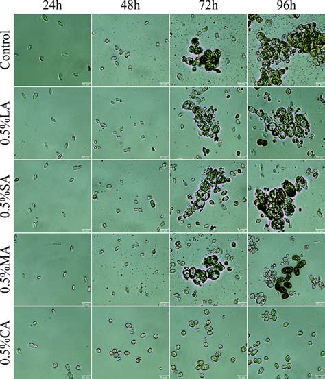 The Cell Morphology Of Aureobasidium Pullulans Ng Grown In Yad Liquid