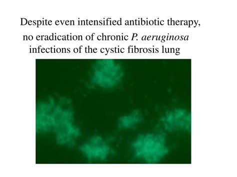 Ppt Pseudomonas Aeruginosa Powerpoint Presentation Free Download