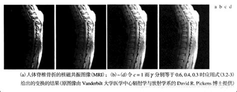 数字图像处理18 图像灰度变换——线性灰度变换 和 非线性灰度变换对数变换 与 伽马变换线性灰度级变换 Csdn博客