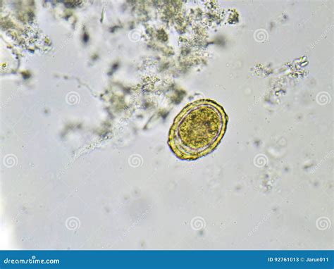 Egg Of Ascaris Lumbricoides Roundworm Stock Image Image Of Micro