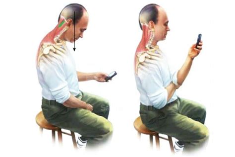 Síndrome Del Text Neck