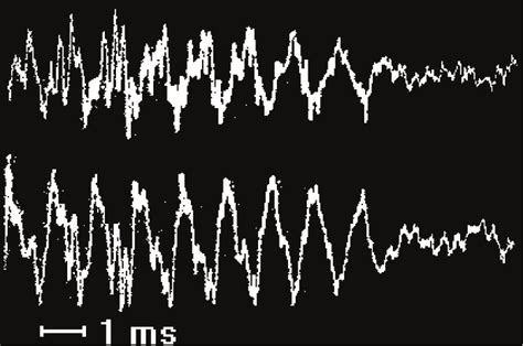 Input Signal Versus Recovered Signal The Top Trace Is The Musical