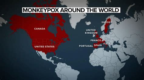 Monkeypox United States 2024 News Dedra Bethena
