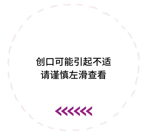 那些被烧伤的人后来都怎么样了 艾邦医用高分子网