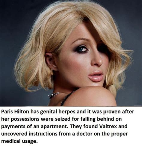 Celebs Who Really Have Stds 15 Pics