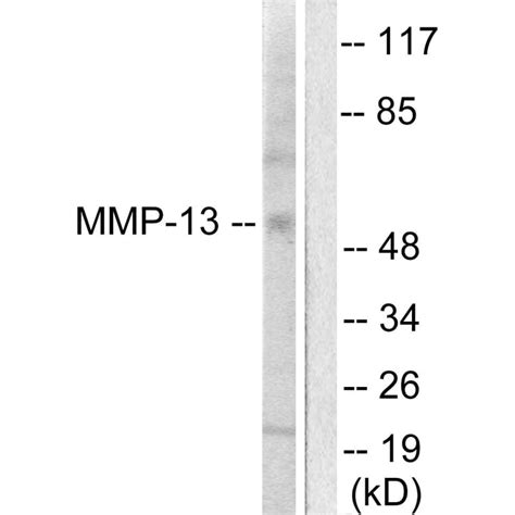 Anti Mmp 13 Antibody A98380