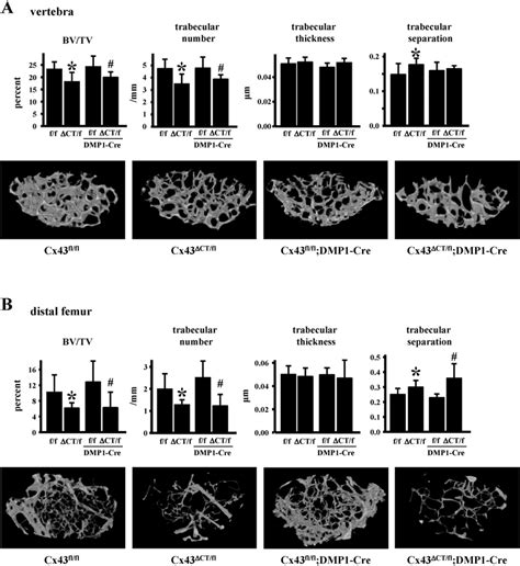 Absence Of Ct Domain Of Cx43 Results In Low Cancellous Bone Volume