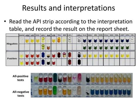 Api 20 E Pdf Operating Systems Computer Software And Applications