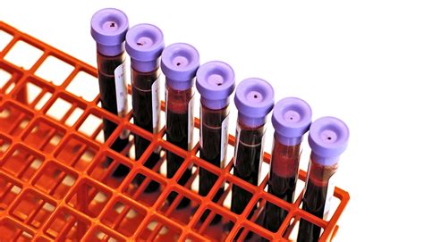 Blood Test Detects 26 Undiagnosed Cancers Futurity