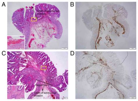 Haggitt Level Invasion Of Sicily