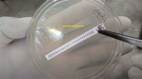 Mueller Hinton Agar MHA Introduction Composition Principle
