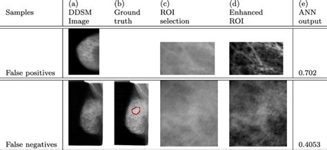 Some Illustrating Misclassified Samples From The DDSM Database False