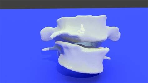 Spine Stl File Processed Spine And Pelvis Embodi D
