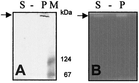 Spua Functional Analysis The Same Polyacrylamide Gel In Which The S