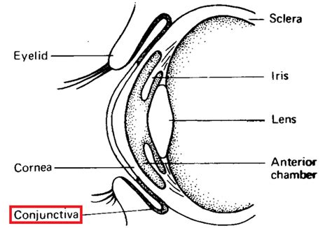 Infective Conjunctivitis Its Pathogenesis Management And Complications Intechopen