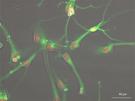 Human Derived Neuron Cell Type Morphology Researchgate