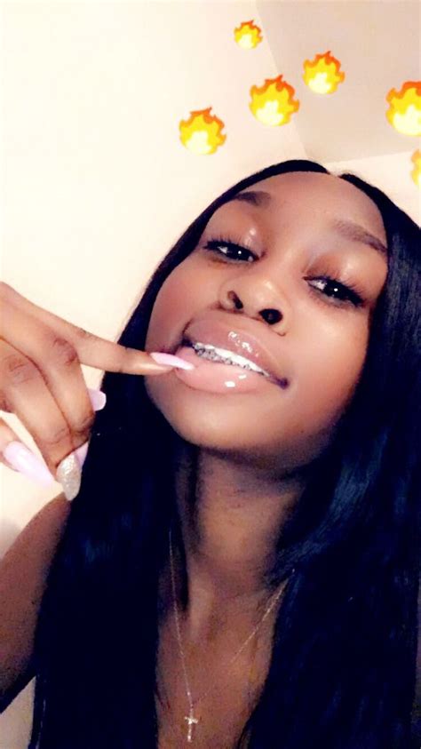 Brace Face Brace Face Face Braces