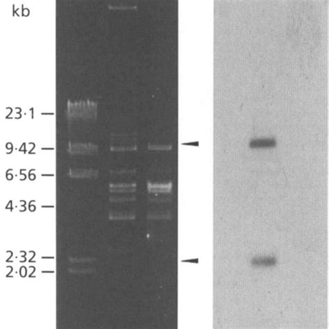 Agarose Gel Electrophoresis Of Plasmid Dna A And Ecori Digested