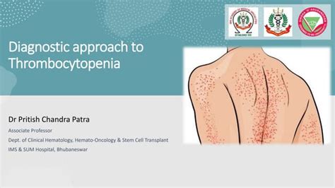 Approach To Thrombocytopenia Pptx