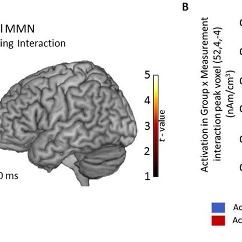 Sagittal And Axial View Of The Statistical Parametric Maps Of The Peaks