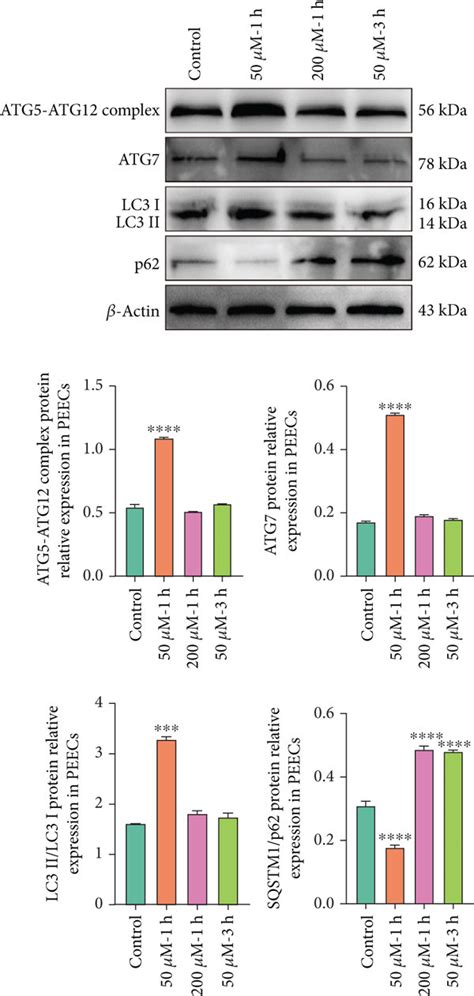Duration And Intensity Of H2o2 Affected Apoptosis And Autophagy In