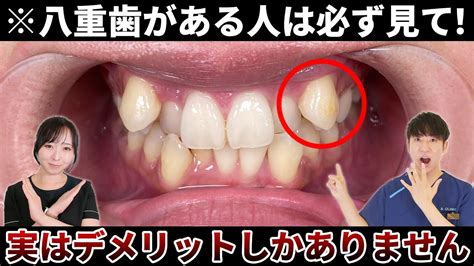 八重歯は可愛いけどデメリット！？ 歯医者が教える真実！ Youtube